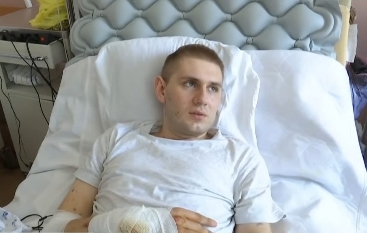Під Ізюмом боєць вижив після підриву на міні але втратив ноги і руку